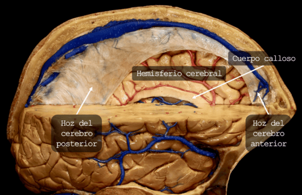 Neuroanatomía: Hoz del cerebro